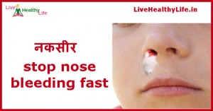 नकसीर - Stop nose bleeding fast - Live healthy life